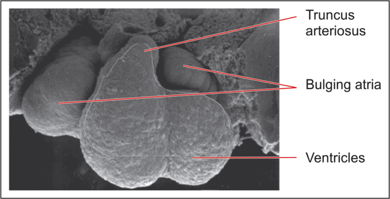 Formation of Heart-Embryo changes - MEDFOXES