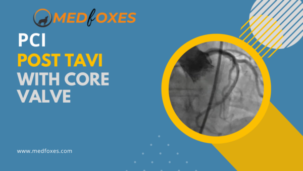 PCI Post TAVI with Core Valve - MEDFOXES