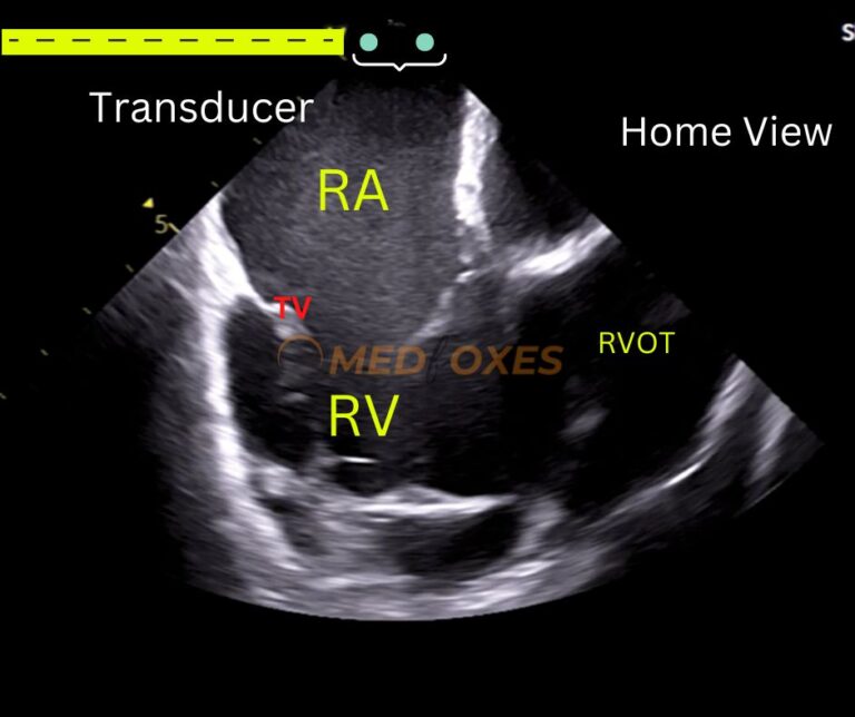 Non-Fluoroscopy ICE Catheter Manipulation – MEDFOXES